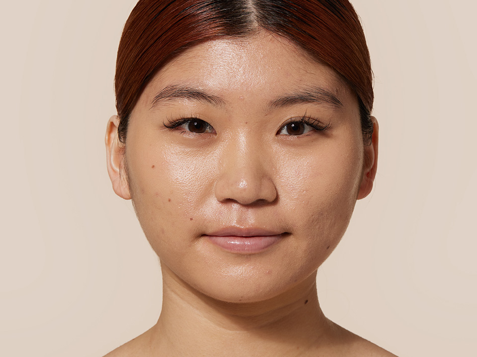 Große Poren verkleinern | BABOR